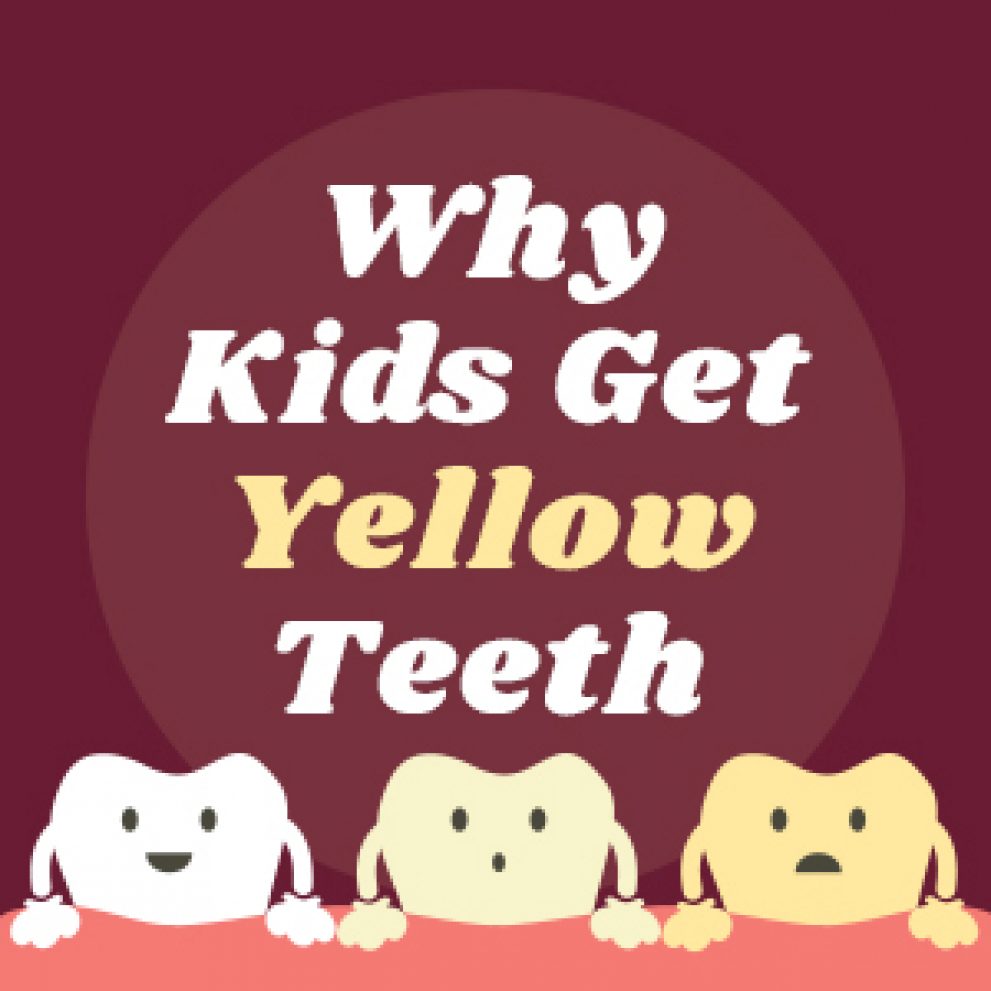 Why Kids Get Yellow Teeth in Odenton | Bayside Kids Dental
